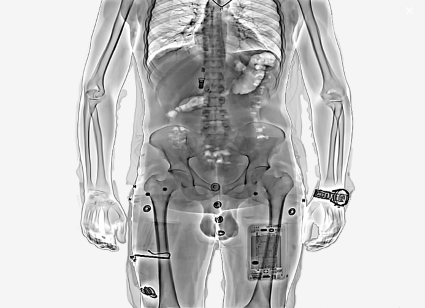 CLEARPASS C.I. | PORTABLE BODY SCANNER - unival group